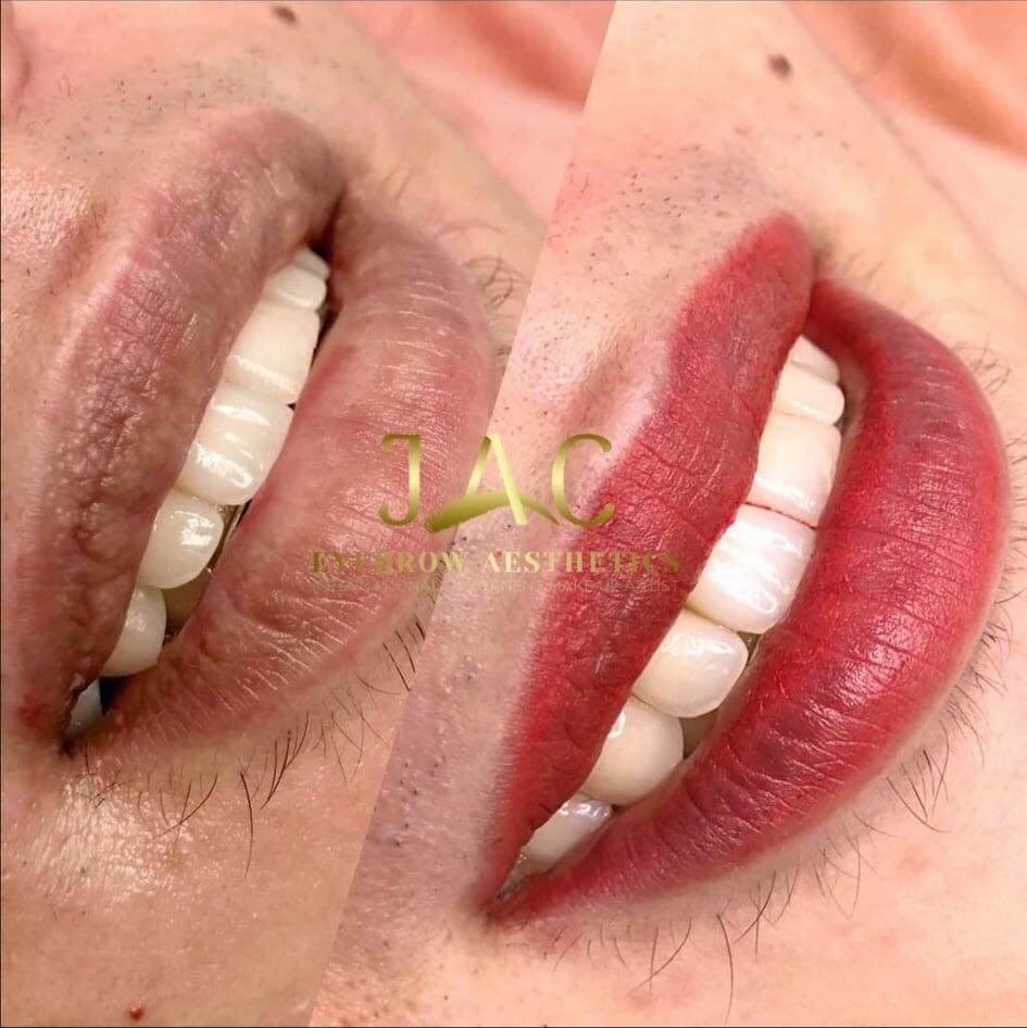 Lip Color Correction | J.A.C Aesthetics